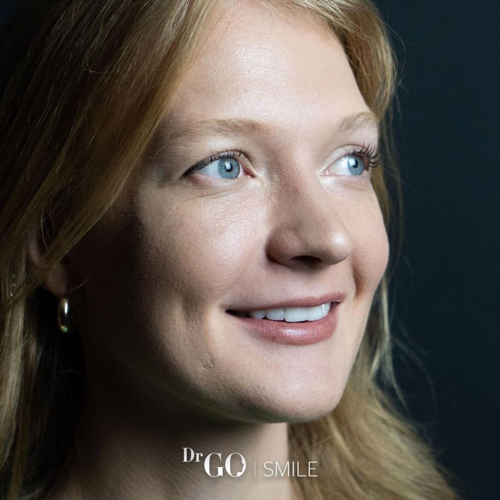 Best Teeth Veneers Treatment Dentist Turkey - DRGO Smile Clinic