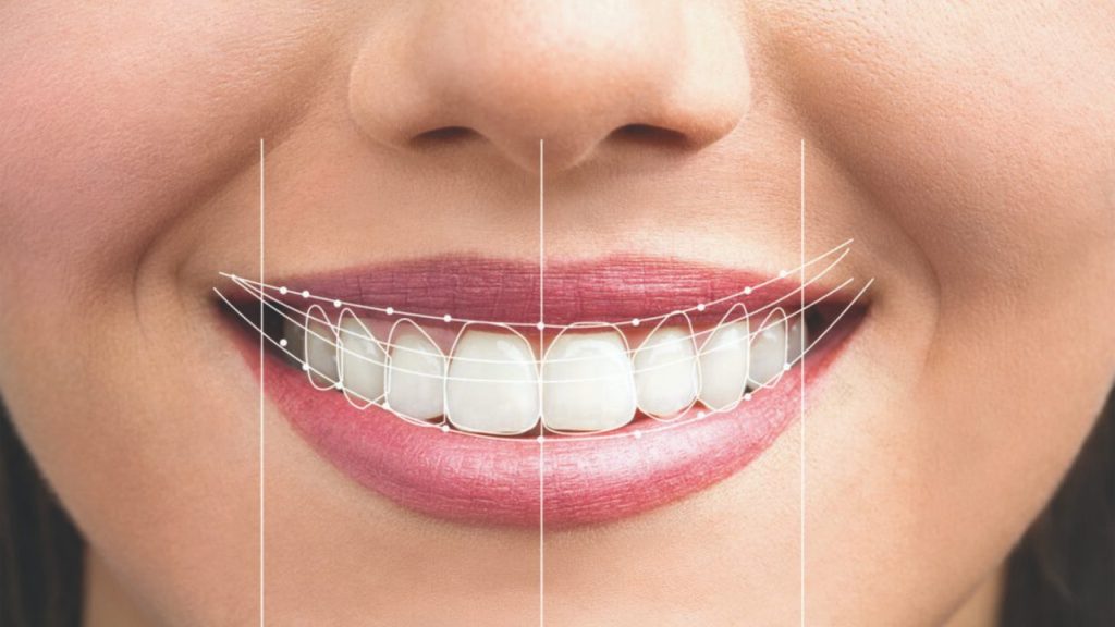 Perfect Smile Design in Istanbul: Your Gateway to a Radiant Smile ...